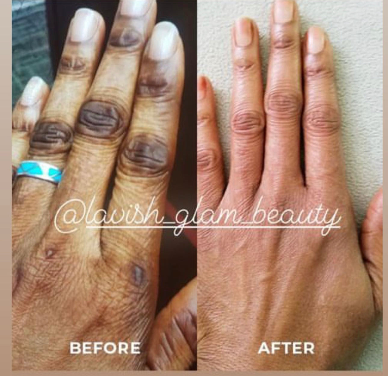 Dark Knuckle Remover Kit – La’Vish Glam® LLC